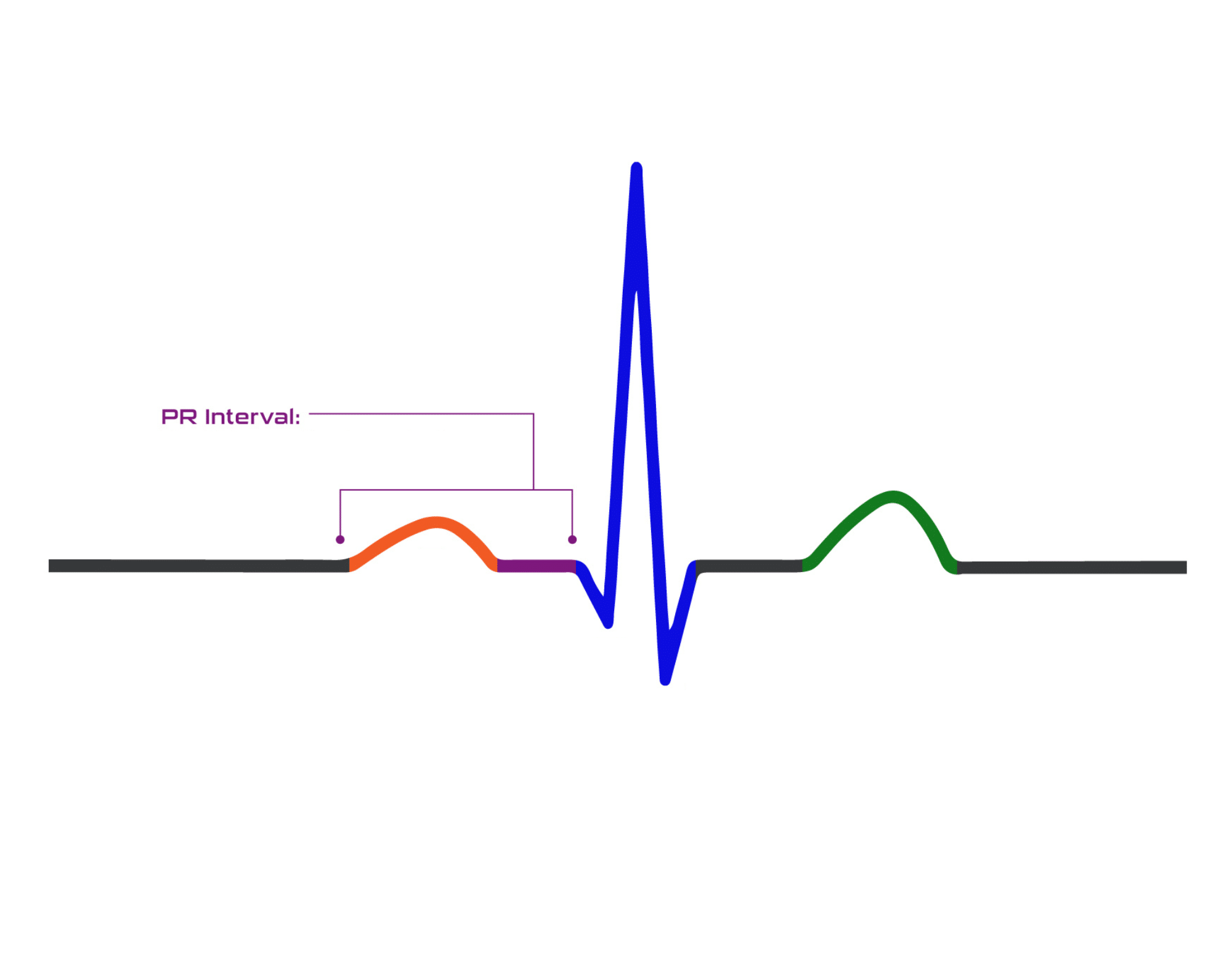 How To Read An Electrocardiogram (EKG/ECG) | SureFire CPR