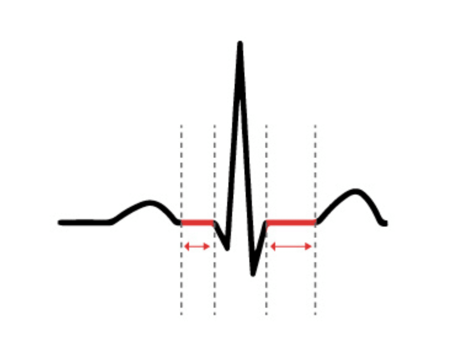 How To Read An Electrocardiogram (EKG/ECG) | SureFire CPR