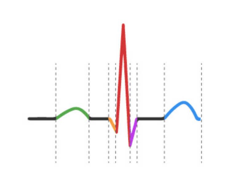 How To Read An Electrocardiogram (EKG/ECG) | SureFire CPR