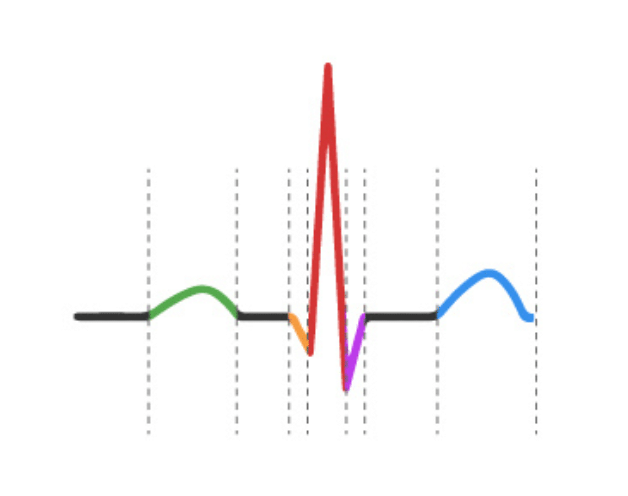 How To Read An Electrocardiogram (EKG/ECG) | SureFire CPR